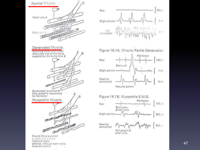 ncs study - basics of nerve conduction study | PPTX | Brain and Nervous ...