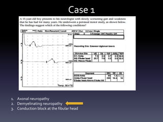 ncs study - basics of nerve conduction study | PPTX