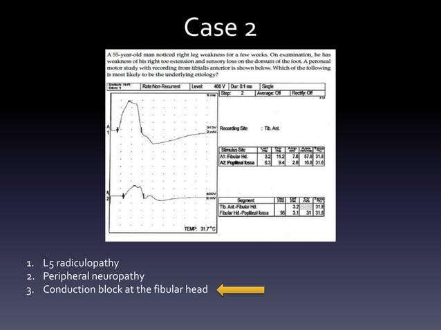 ncs study - basics of nerve conduction study | PPTX | Brain and Nervous ...