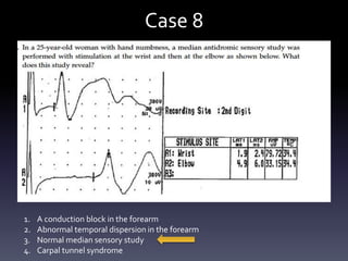 ncs study - basics of nerve conduction study | PPTX