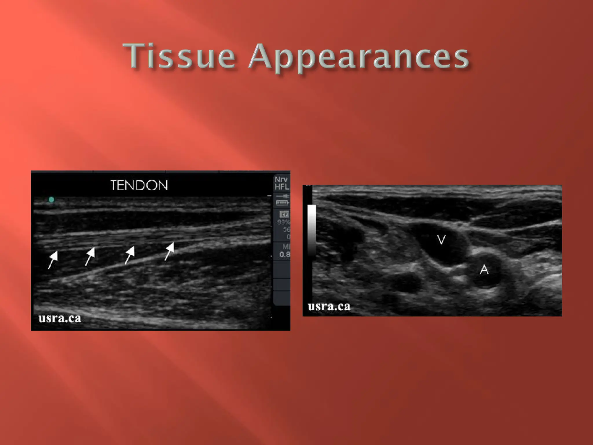 Basics-Ultrasound the first lecture.pptx