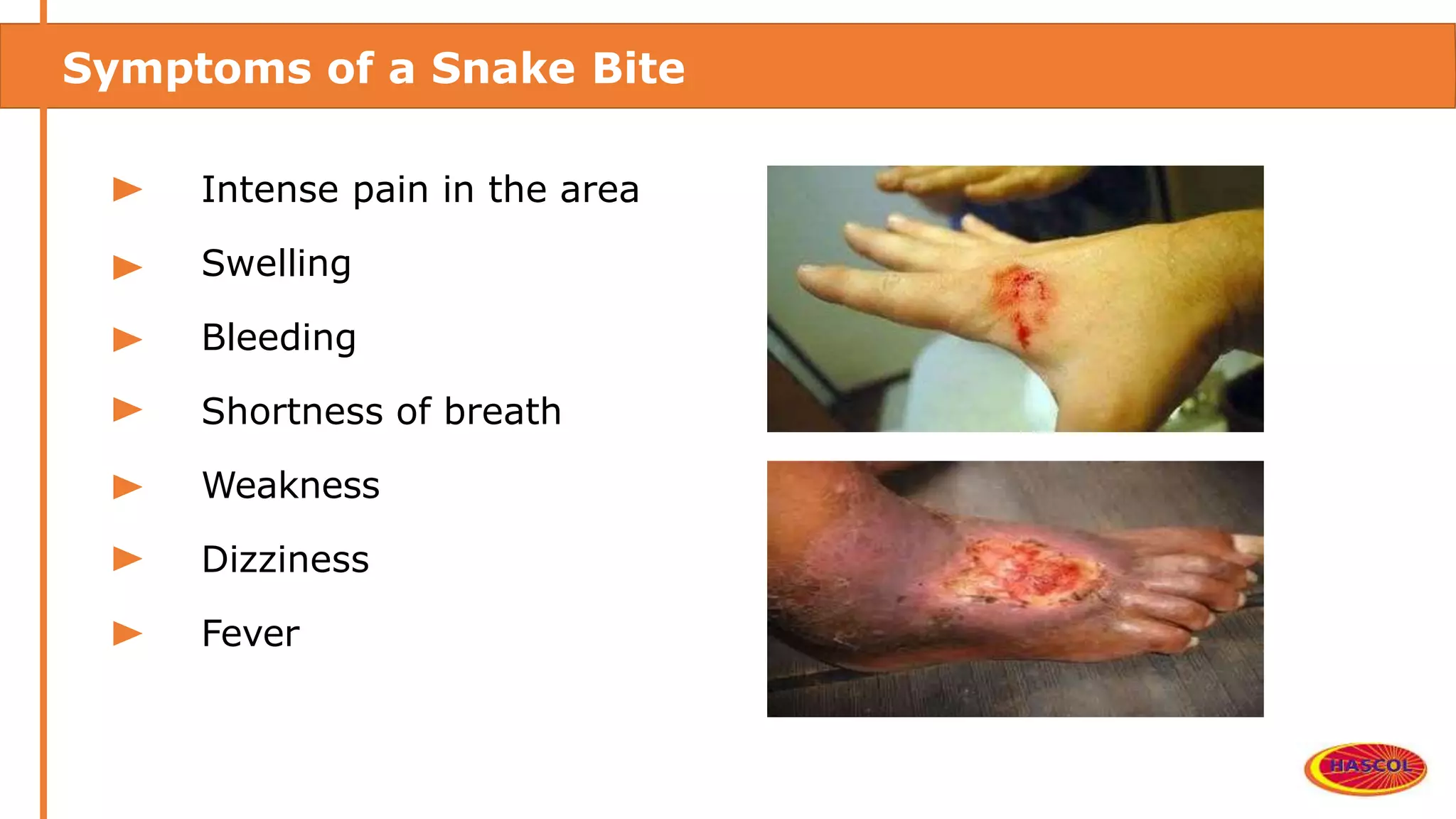 Basic safety against snake bite at work place | PPTX