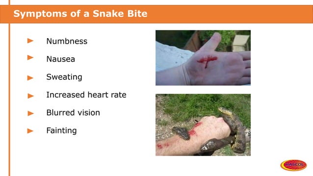Basic safety against snake bite at work place | PPTX | First Aid | Injuries