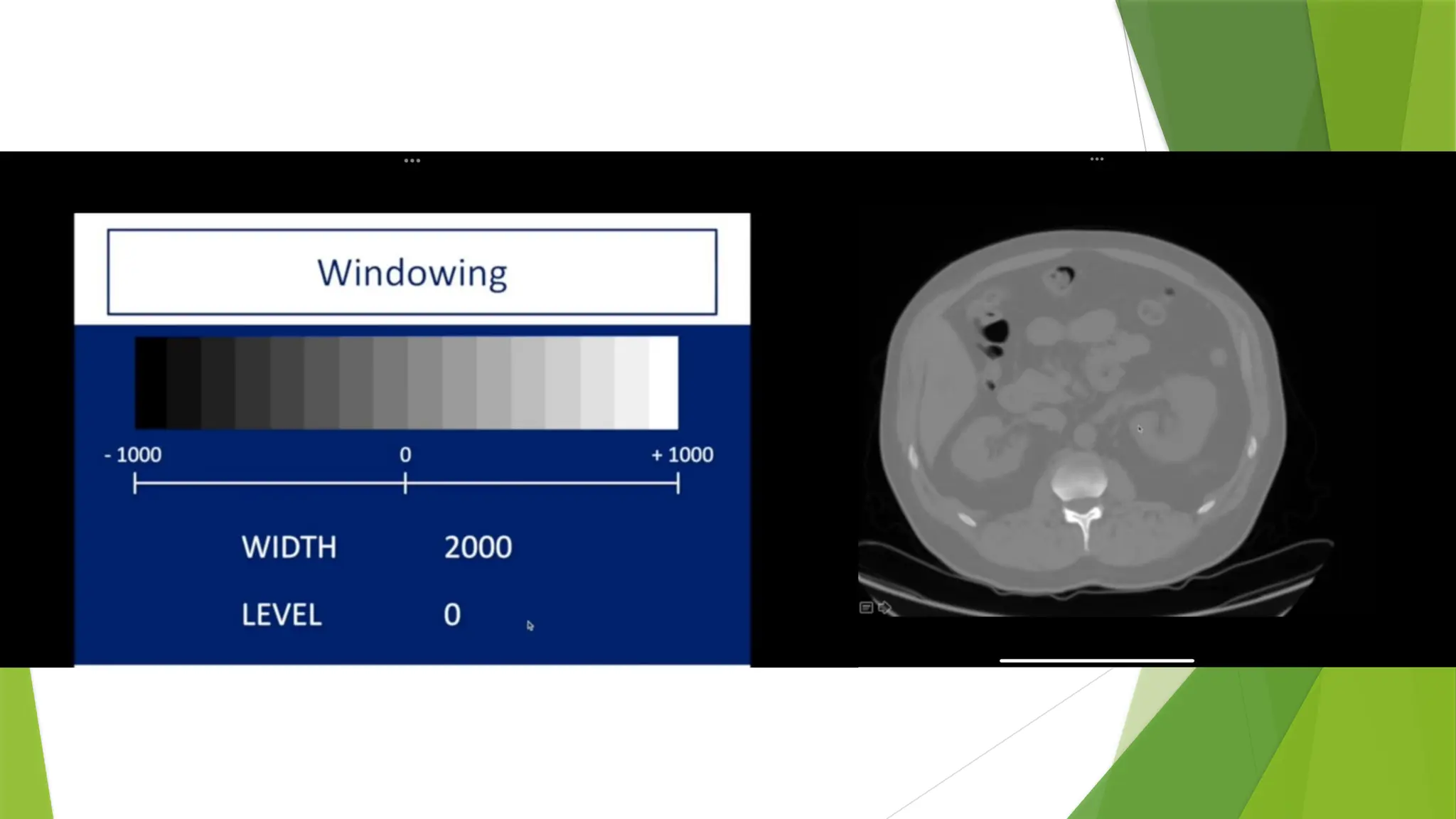 BASICS AND PRINCIPLES OF CT SCAN and windowing.pptx