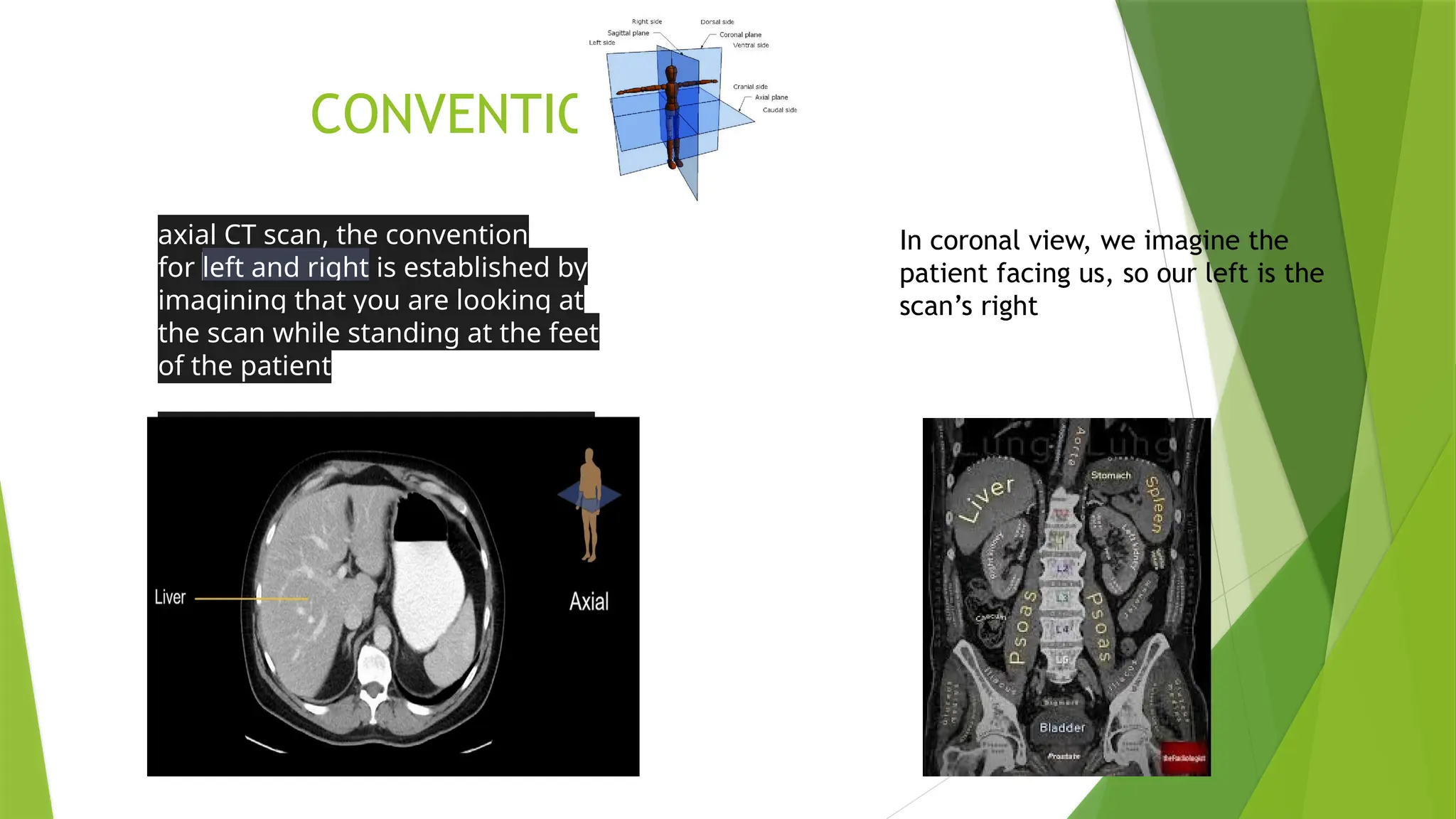BASICS AND PRINCIPLES OF CT SCAN and windowing.pptx