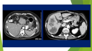 BASICS AND PRINCIPLES OF CT SCAN and windowing.pptx
