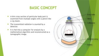 BASICS AND PRINCIPLES OF CT SCAN and windowing.pptx