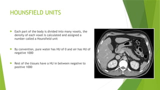 BASICS AND PRINCIPLES OF CT SCAN and windowing.pptx