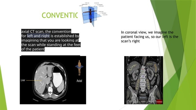 BASICS AND PRINCIPLES OF CT SCAN and windowing.pptx