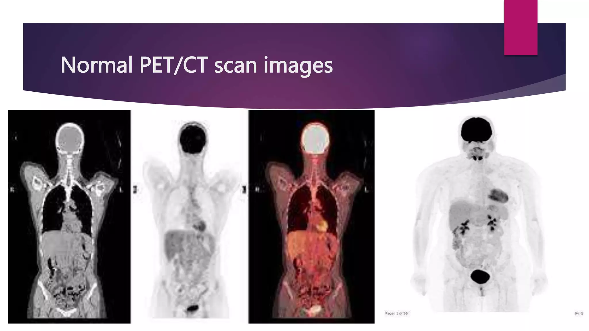 Basics and principles of PET.pptx