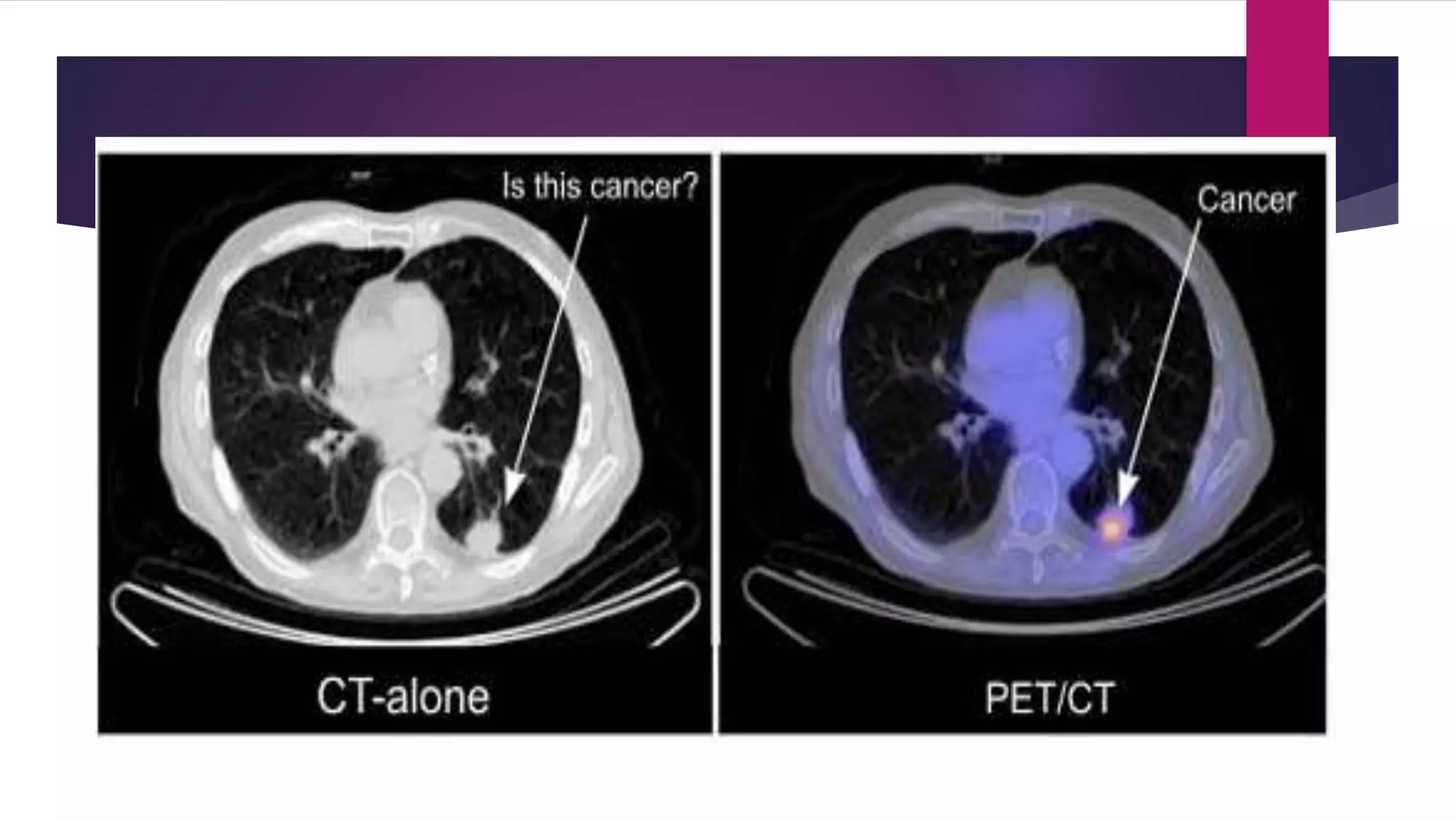 Basics and principles of PET.pptx
