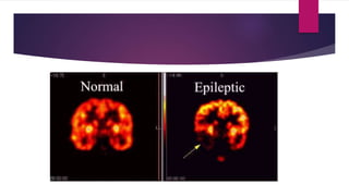 Basics and principles of PET.pptx