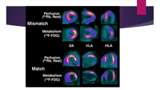 Basics and principles of PET.pptx
