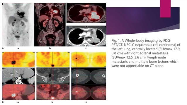 Basics and principles of PET.pptx