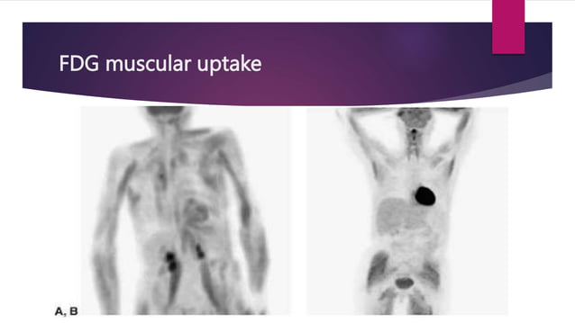 Basics and principles of PET.pptx