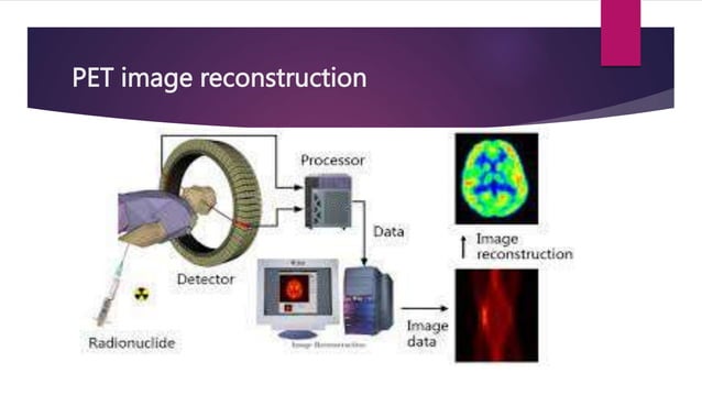 Basics and principles of PET.pptx