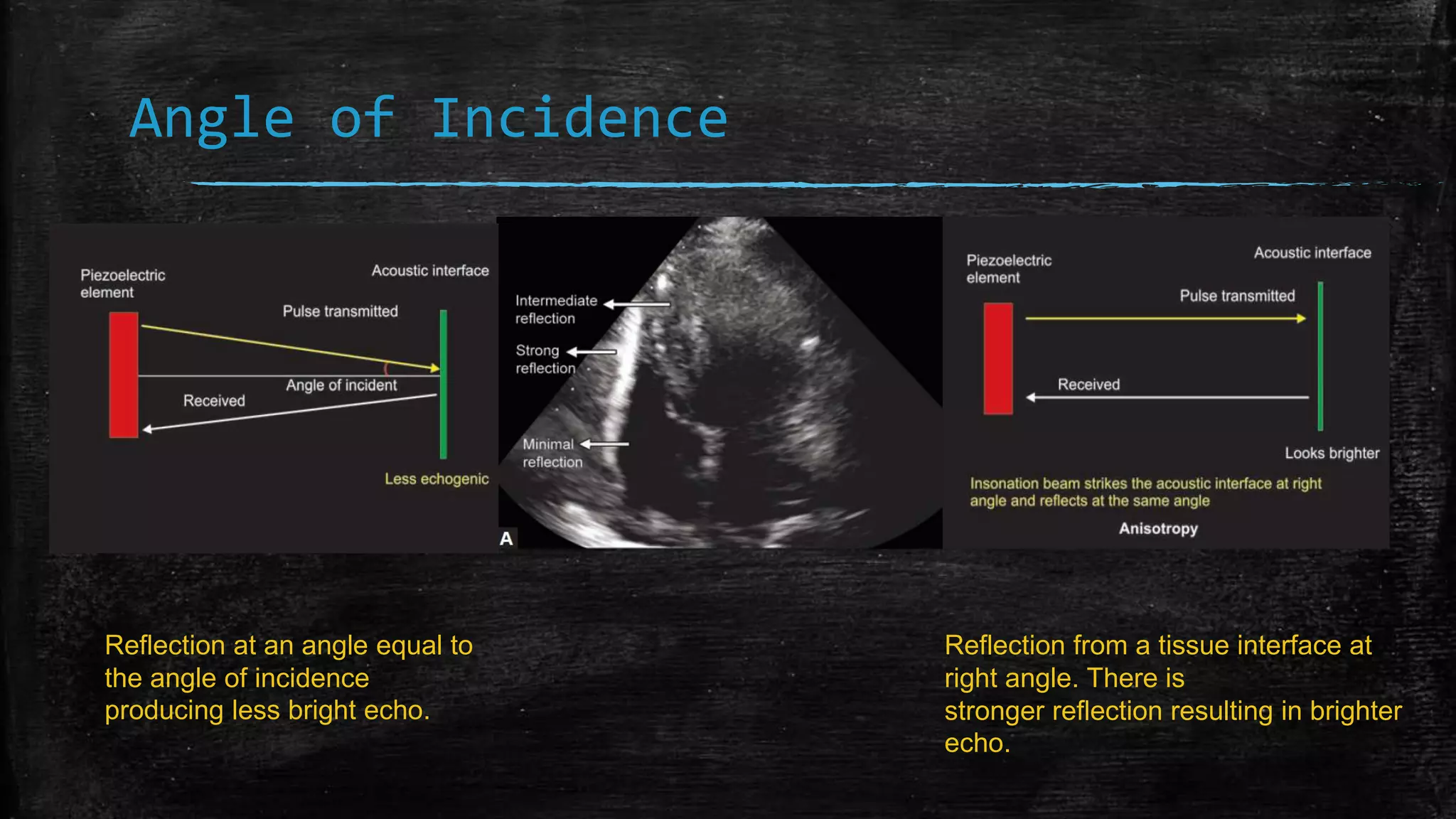 Basics/Physics of Echocardiography | PPTX