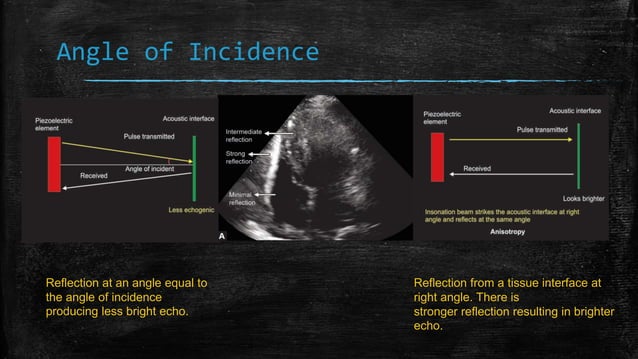 Basics/Physics of Echocardiography | PPTX