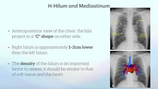 basics of chest xray with labelled diagram.pdf
