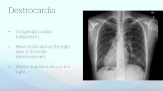 basics of chest xray with labelled diagram.pdf