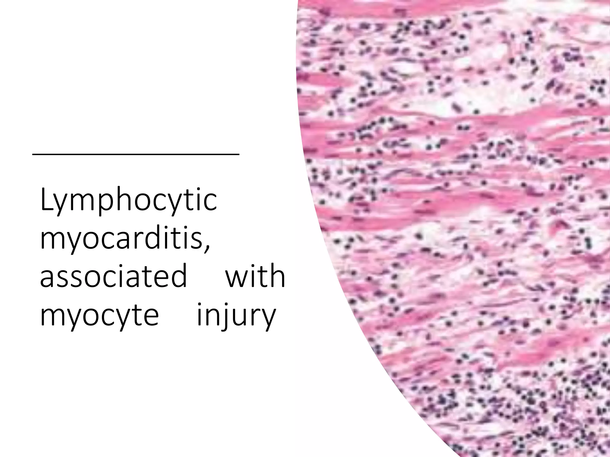 Basic science and forensic pathology aspects of myocarditis | PPTX