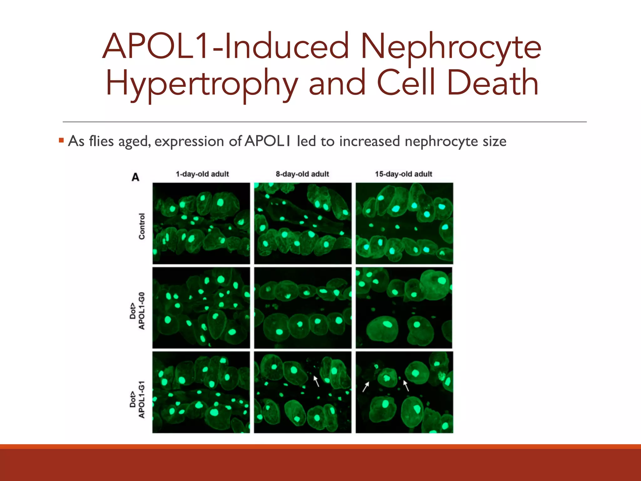 Basic science apol1 gene and nephrocyte chaken | PDF