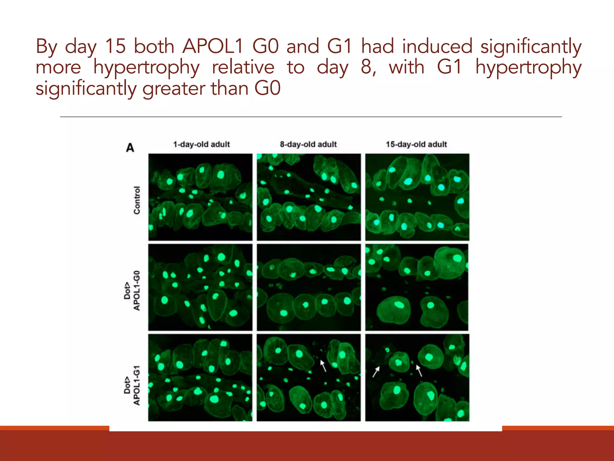 Basic science apol1 gene and nephrocyte chaken | PDF