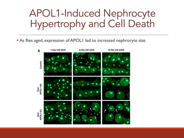 Basic science apol1 gene and nephrocyte chaken | PDF