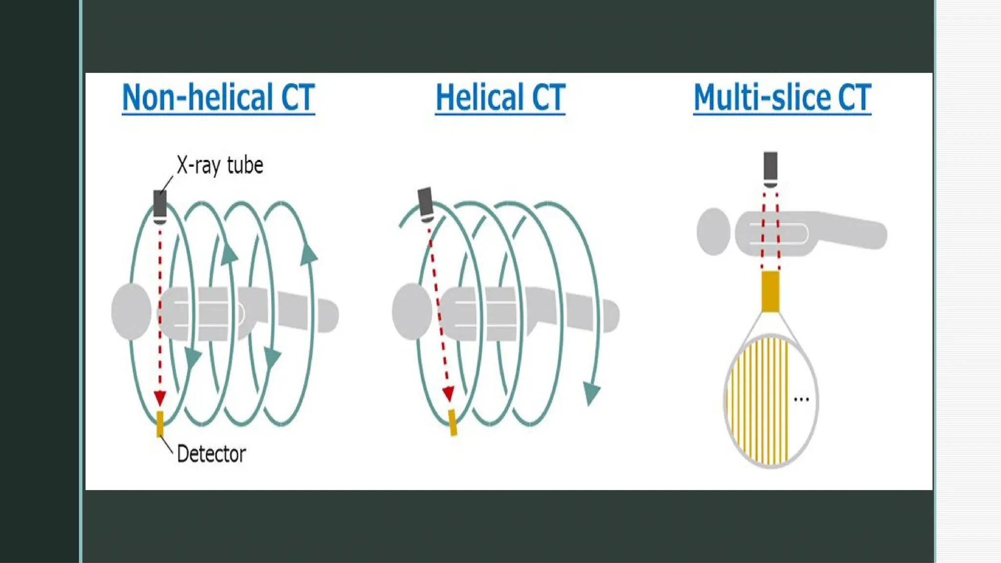 Basics In Ct Computed Tomography Ct Generations Computed Tomography Working Principle