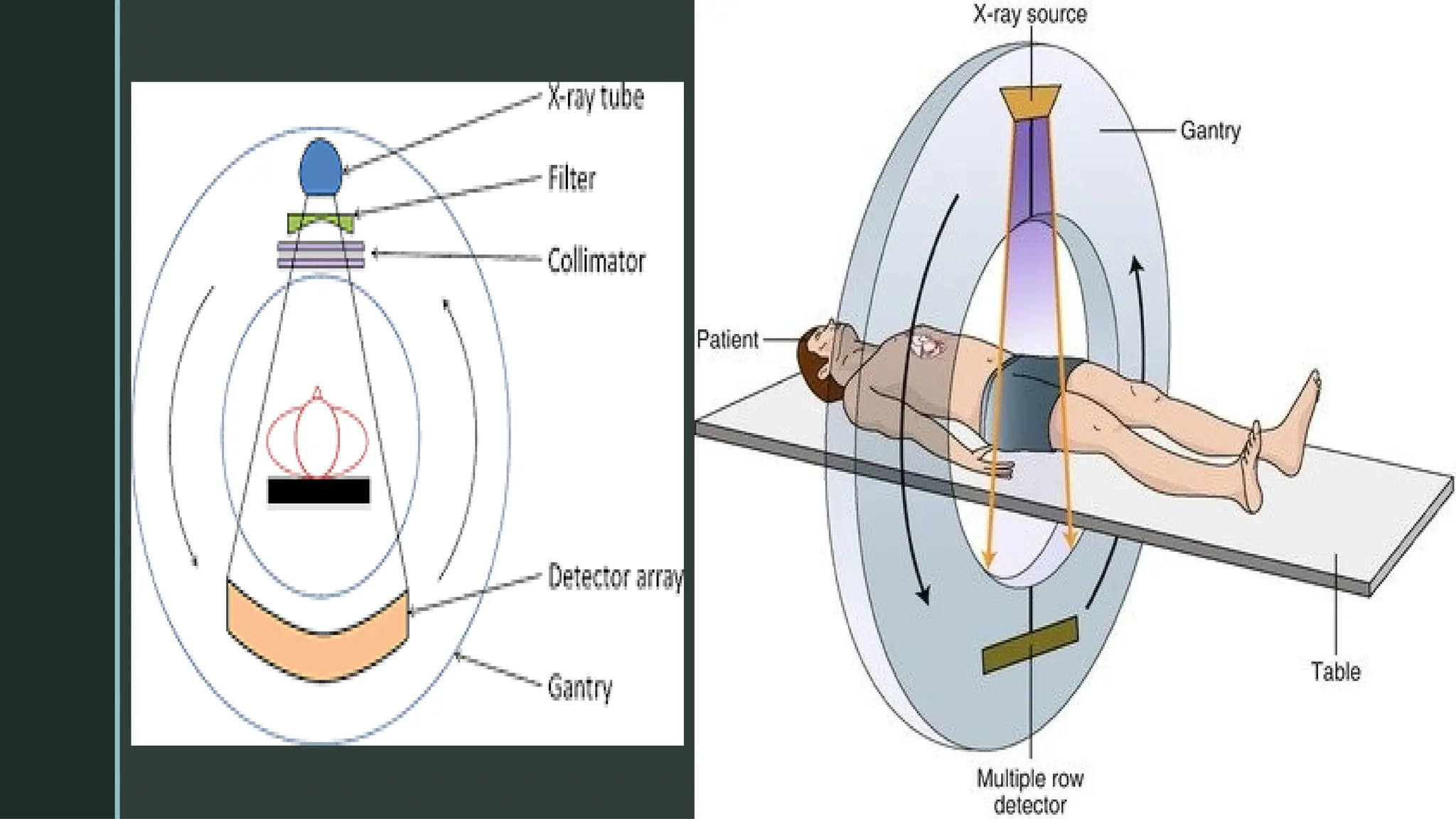 Basics in CT/ Computed Tomography / CT generations/ Computed Tomography ...