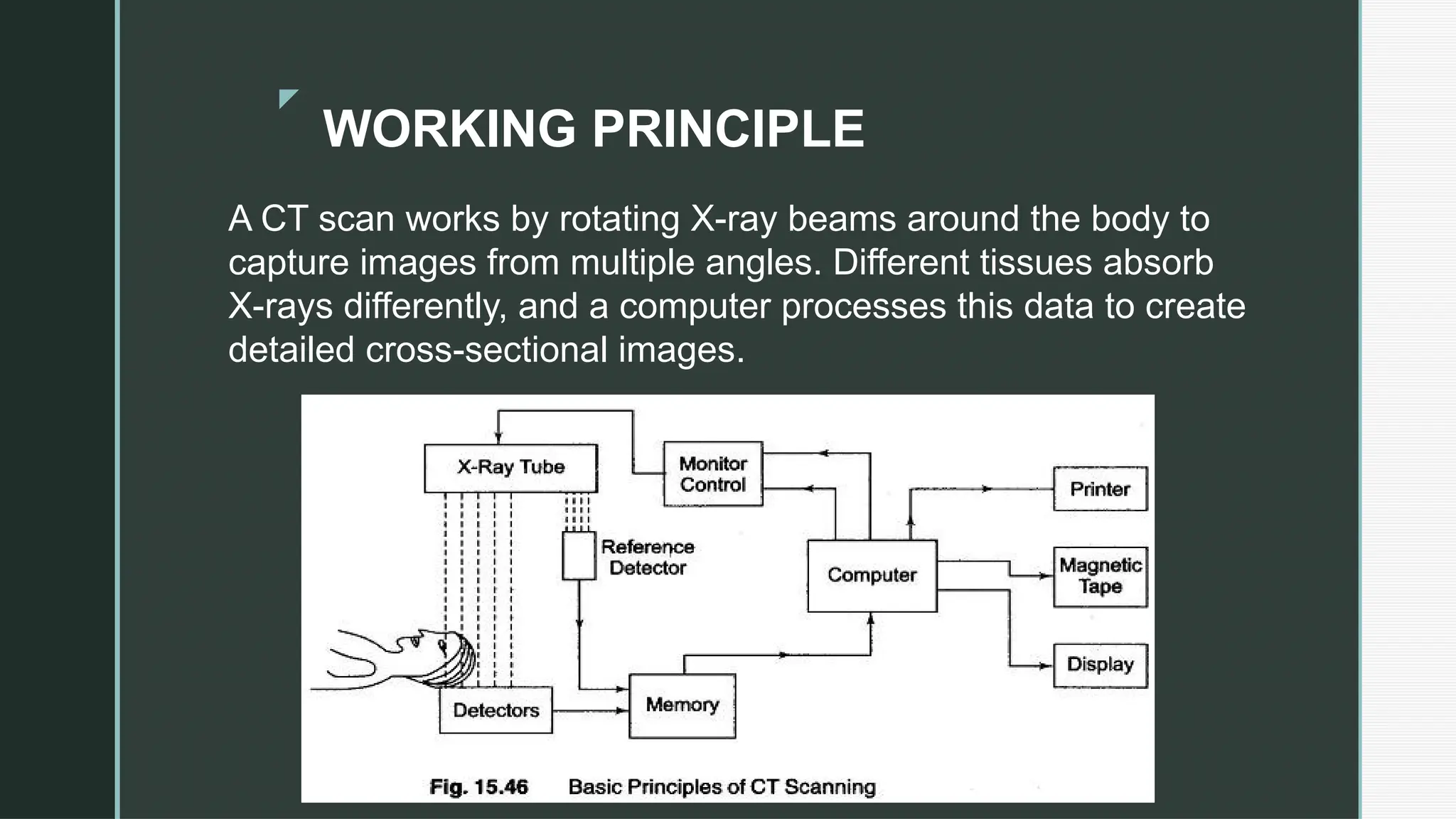 Basics in CT/ Computed Tomography / CT generations/ Computed Tomography working principle ...