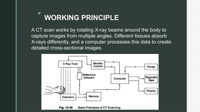 Basics in CT/ Computed Tomography / CT generations/ Computed Tomography ...