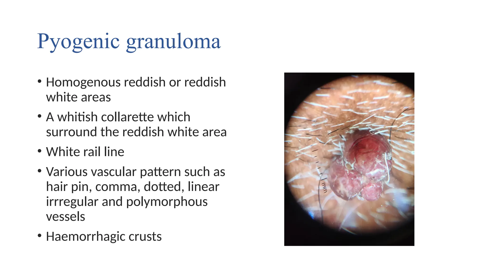 BASICS IN DERMOSCOPY for clinical diagnosis | PPTX