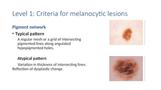 BASICS IN DERMOSCOPY for clinical diagnosis | PPTX