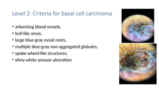 BASICS IN DERMOSCOPY for clinical diagnosis | PPTX