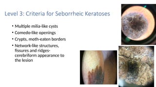 BASICS IN DERMOSCOPY for clinical diagnosis | PPTX