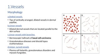 BASICS IN DERMOSCOPY for clinical diagnosis | PPTX