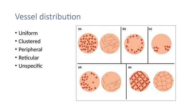 BASICS IN DERMOSCOPY for clinical diagnosis | PPTX