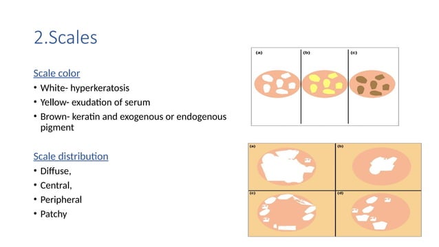 BASICS IN DERMOSCOPY for clinical diagnosis | PPTX