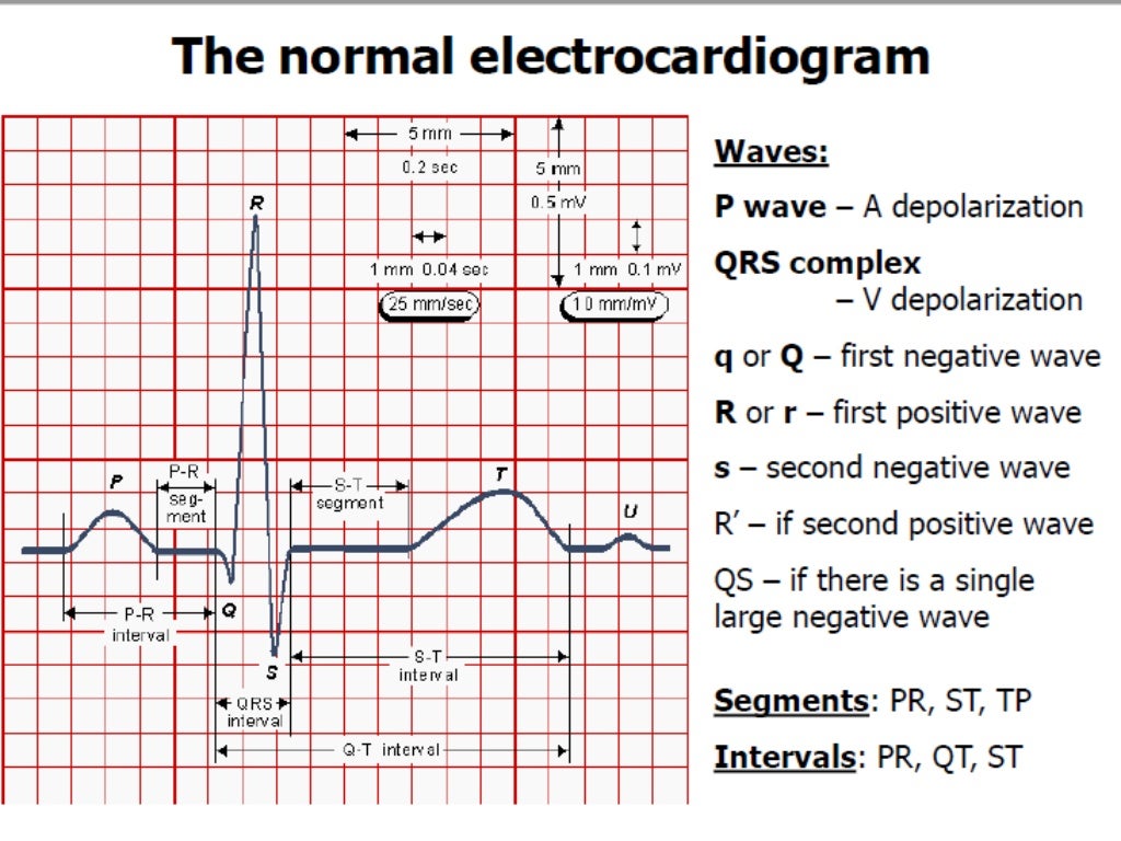 BASICS IN ELECTROCARDIOGRAPHY