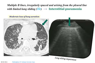 Basic skills in transthoracic lung ultrasound | PPTX
