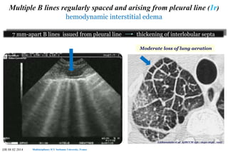 Basic skills in transthoracic lung ultrasound | PPTX