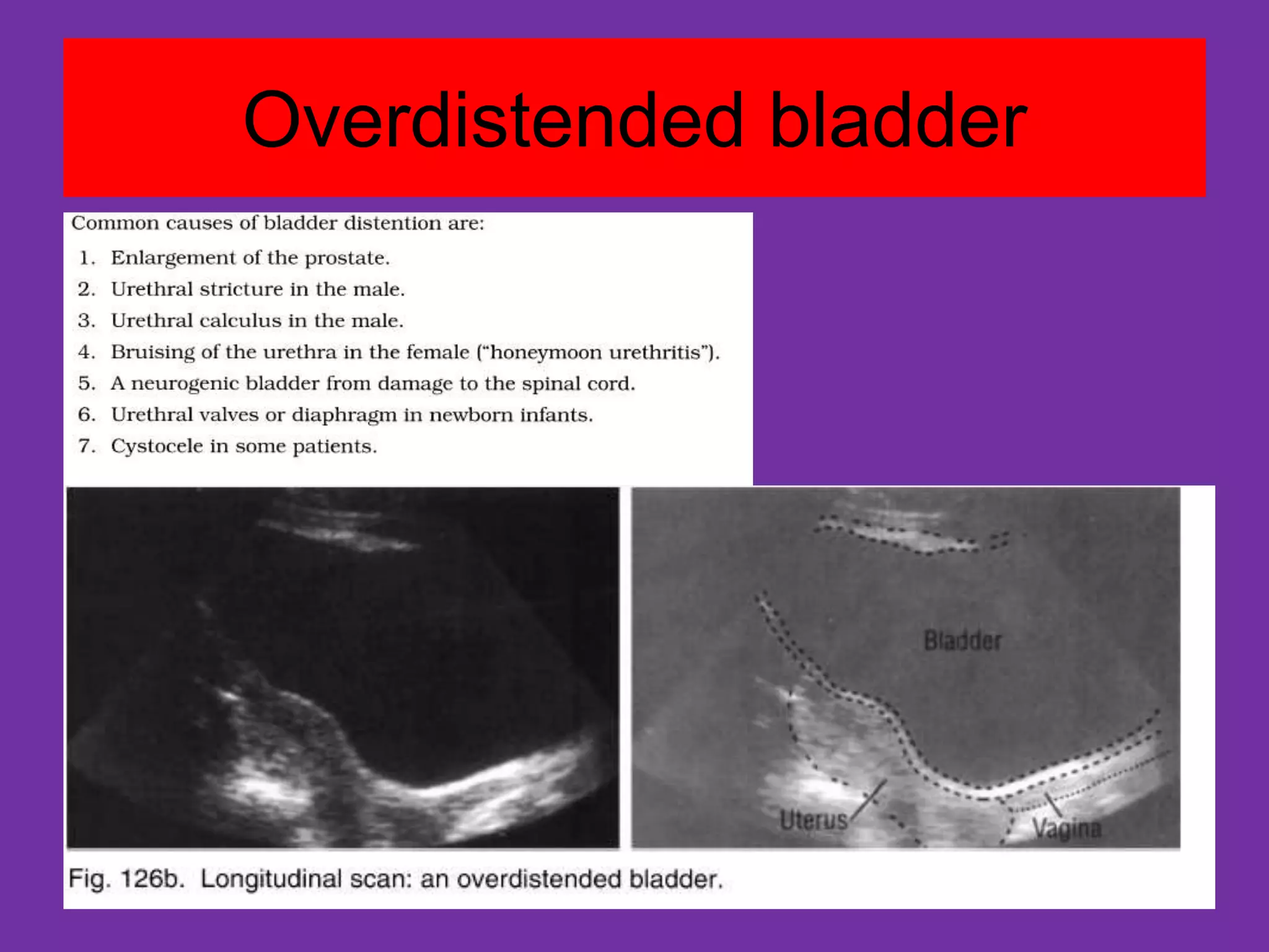 Basic skills of urinary tract ultrasound | PPT