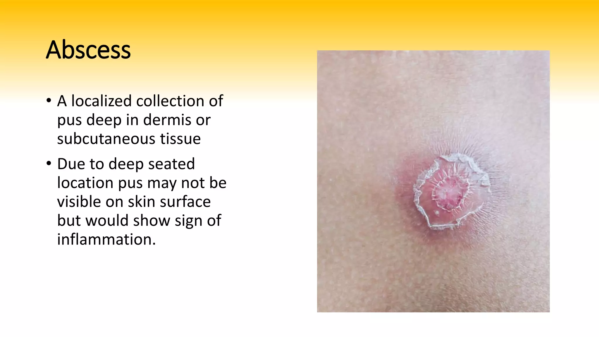 Basic skin lesions | PPTX