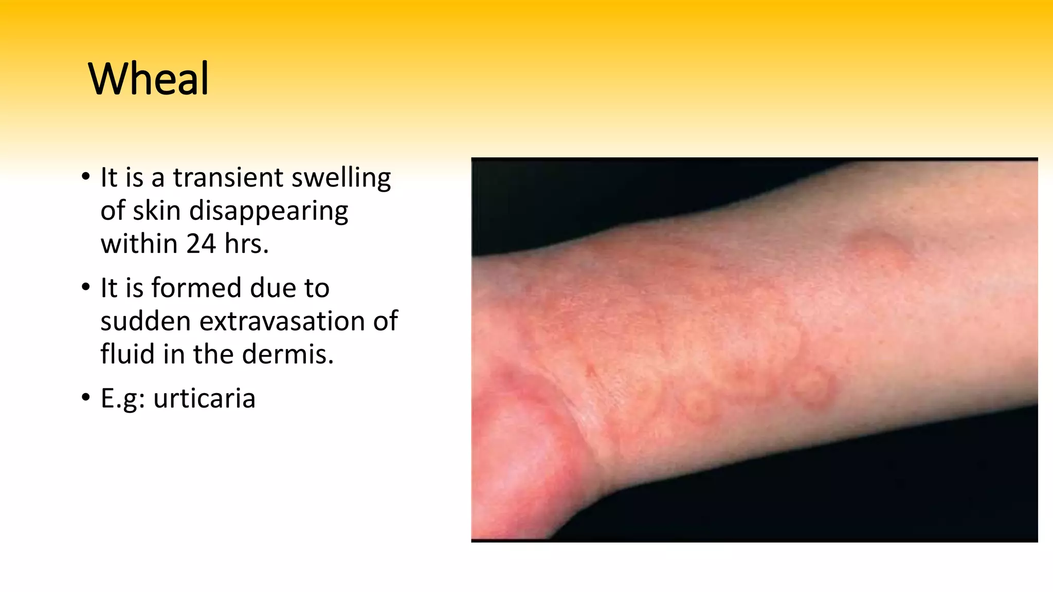 Basic skin lesions | PPTX