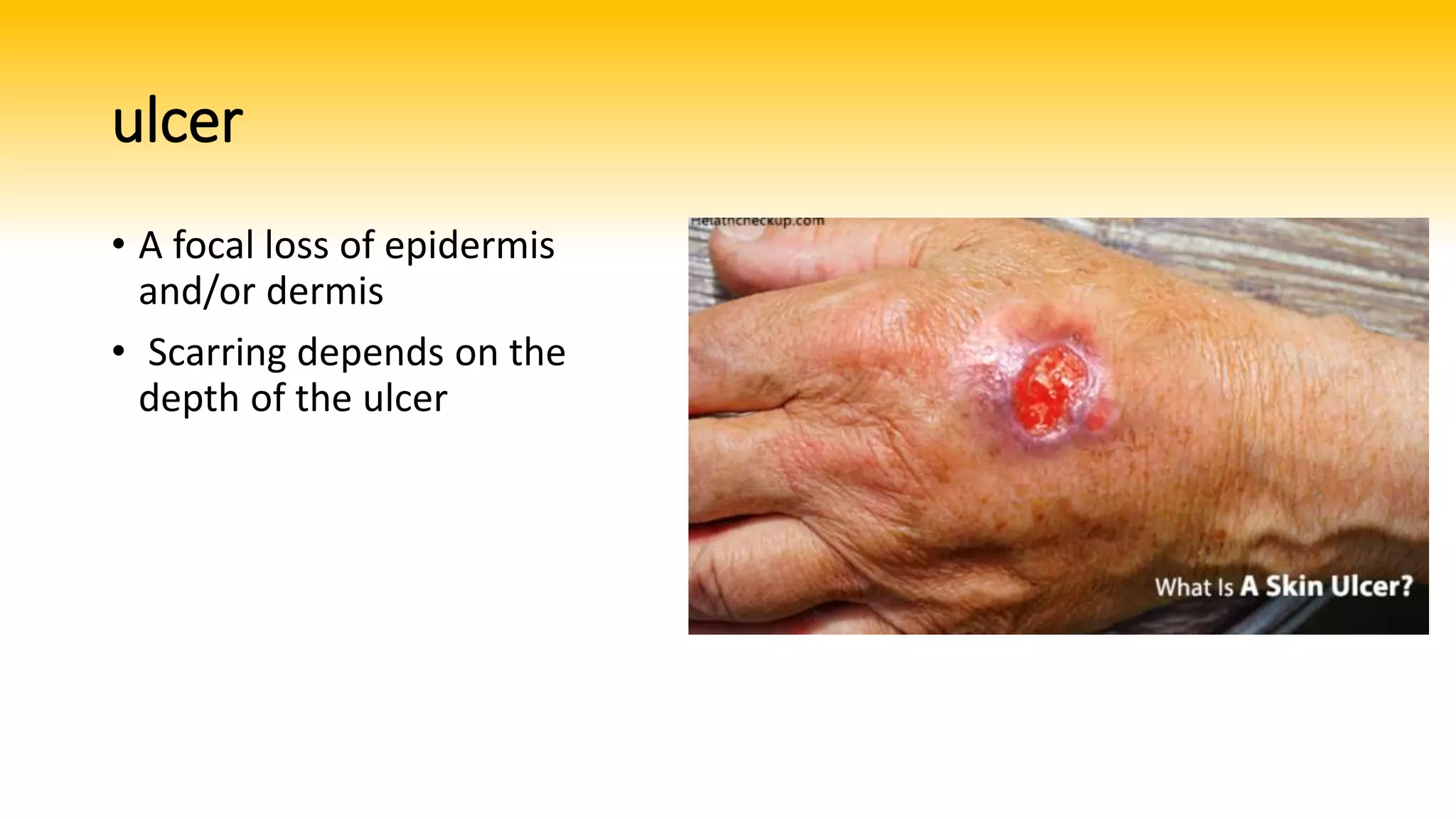 Basic skin lesions | PPTX