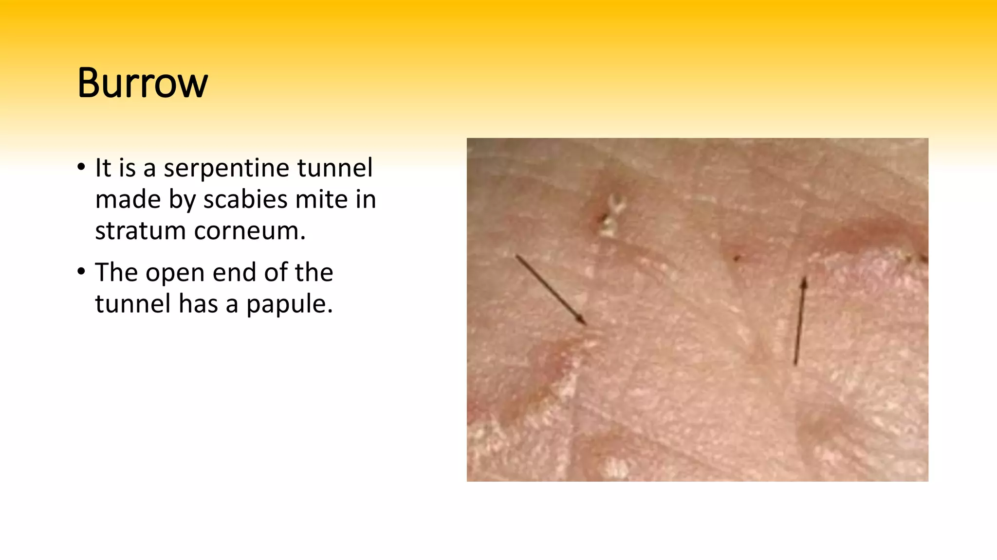 Basic skin lesions | PPTX