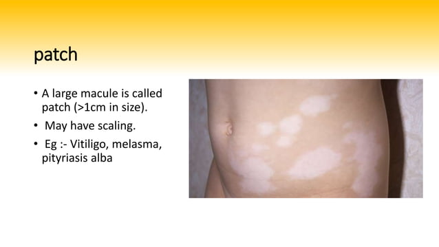 Basic skin lesions | PPTX | Skin and Dermatology | Diseases and Conditions