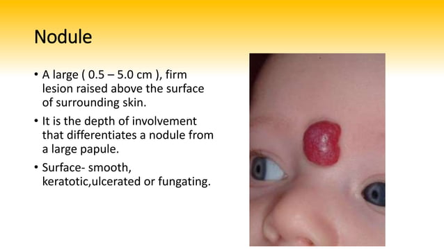 Basic skin lesions | PPTX | Skin and Dermatology | Diseases and Conditions