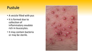 Basic skin lesions | PPTX